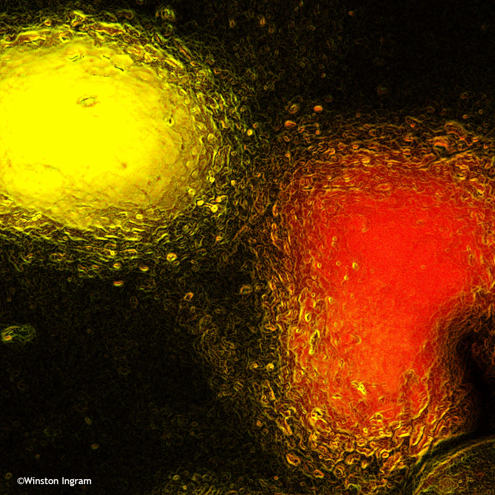 Spices | Microbus Microscope Educational Website