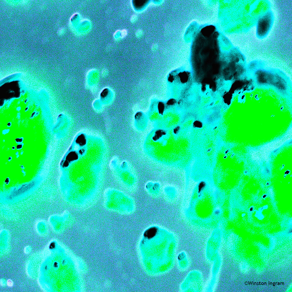 Spices | Microbus Microscope Educational Website