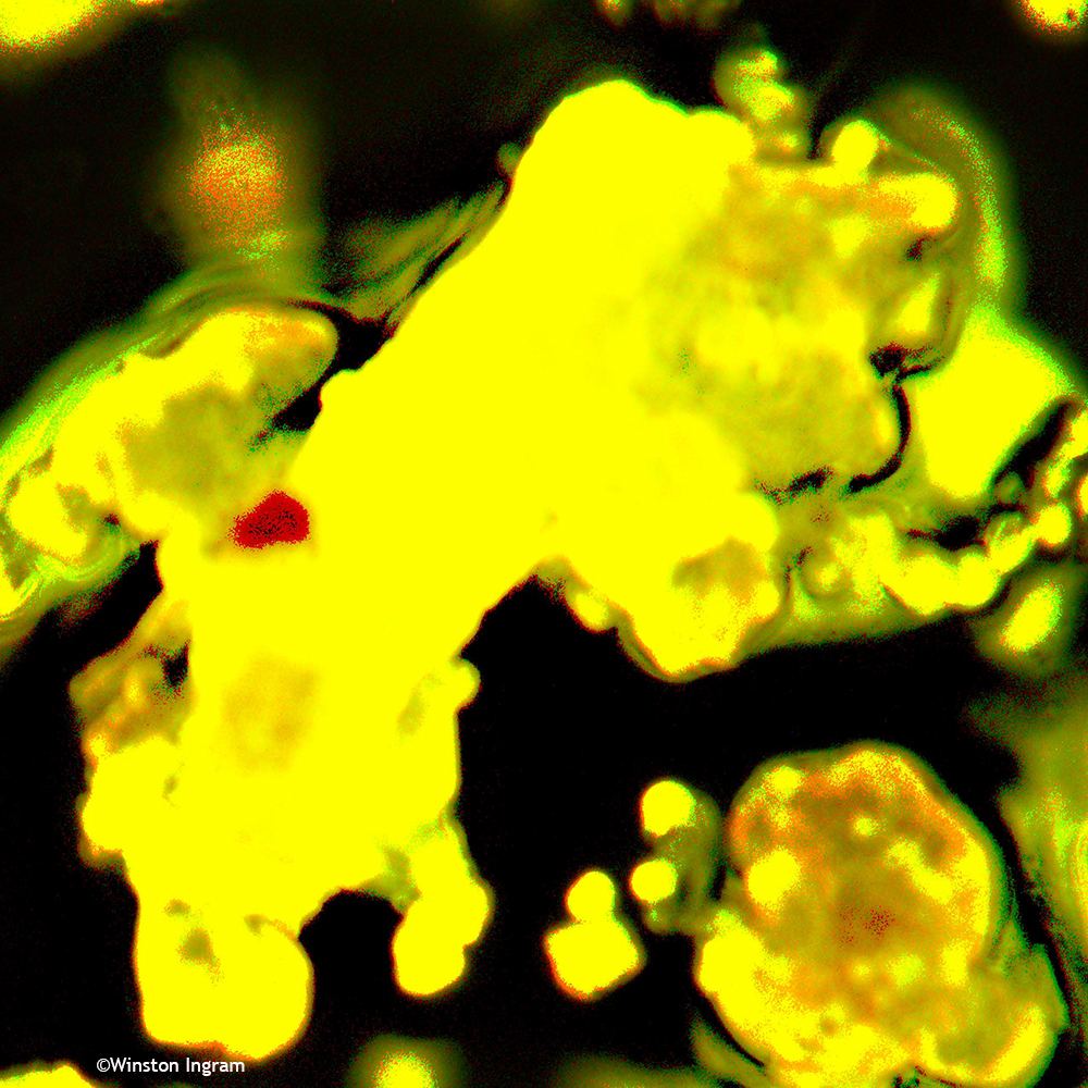 Spices | Microbus Microscope Educational Website