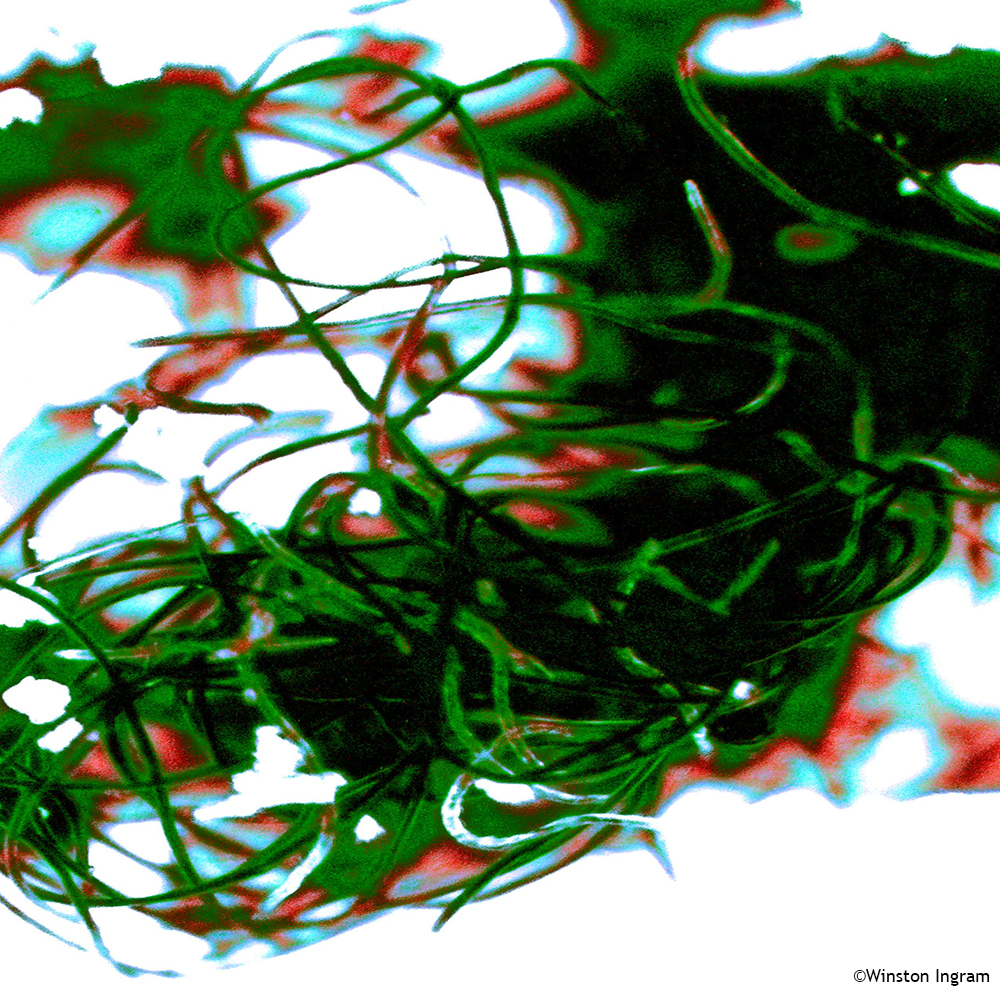 Spices | Microbus Microscope Educational Website