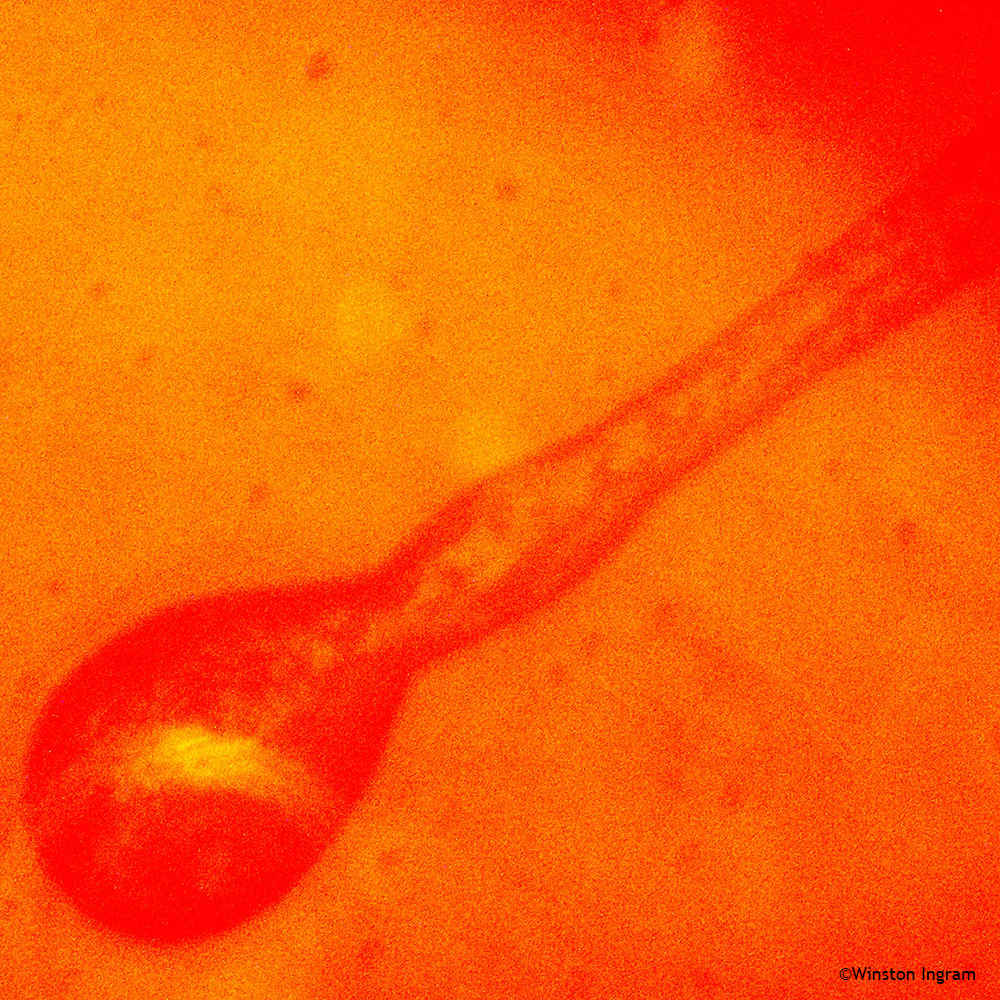 Spices | Microbus Microscope Educational Website