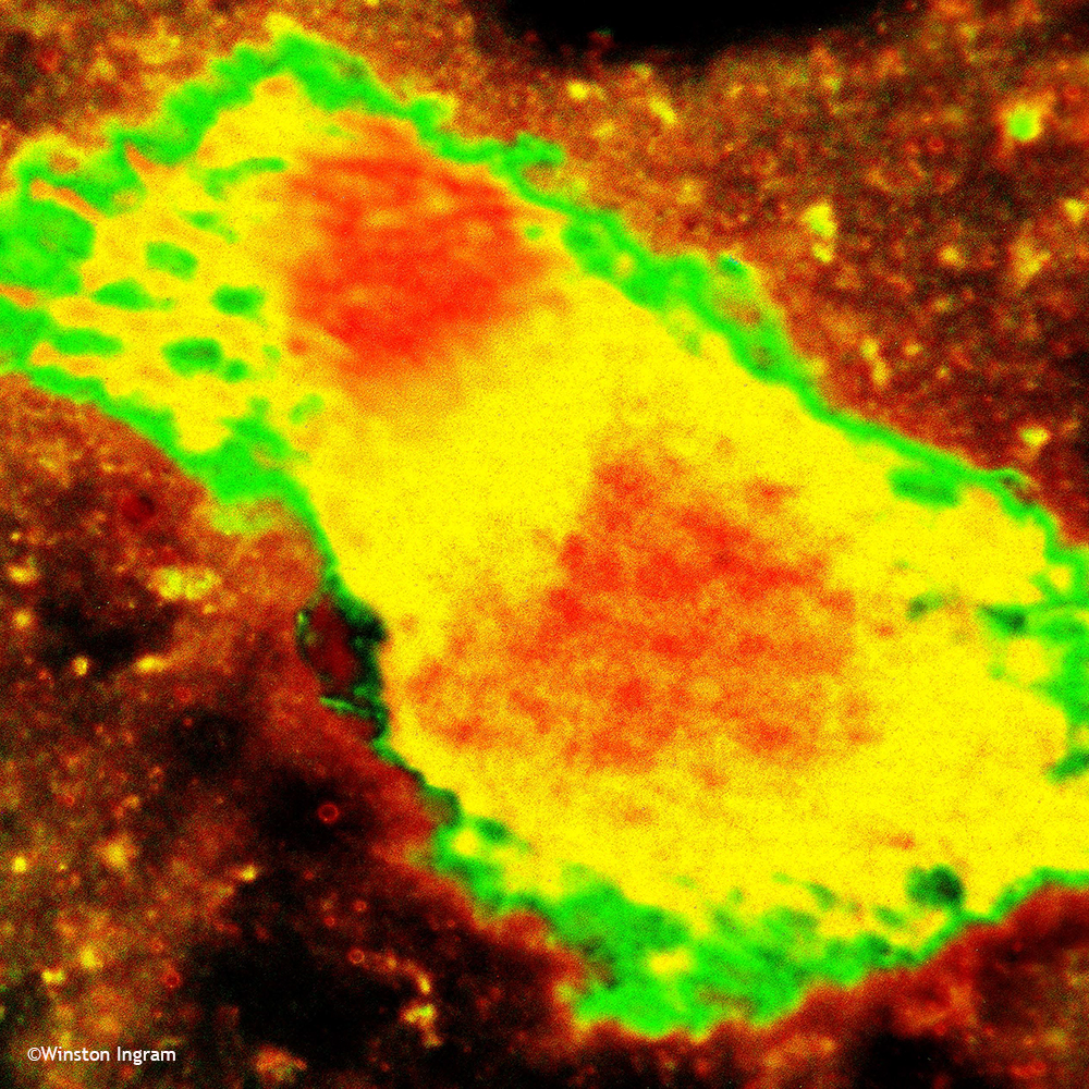 Spices | Microbus Microscope Educational Website