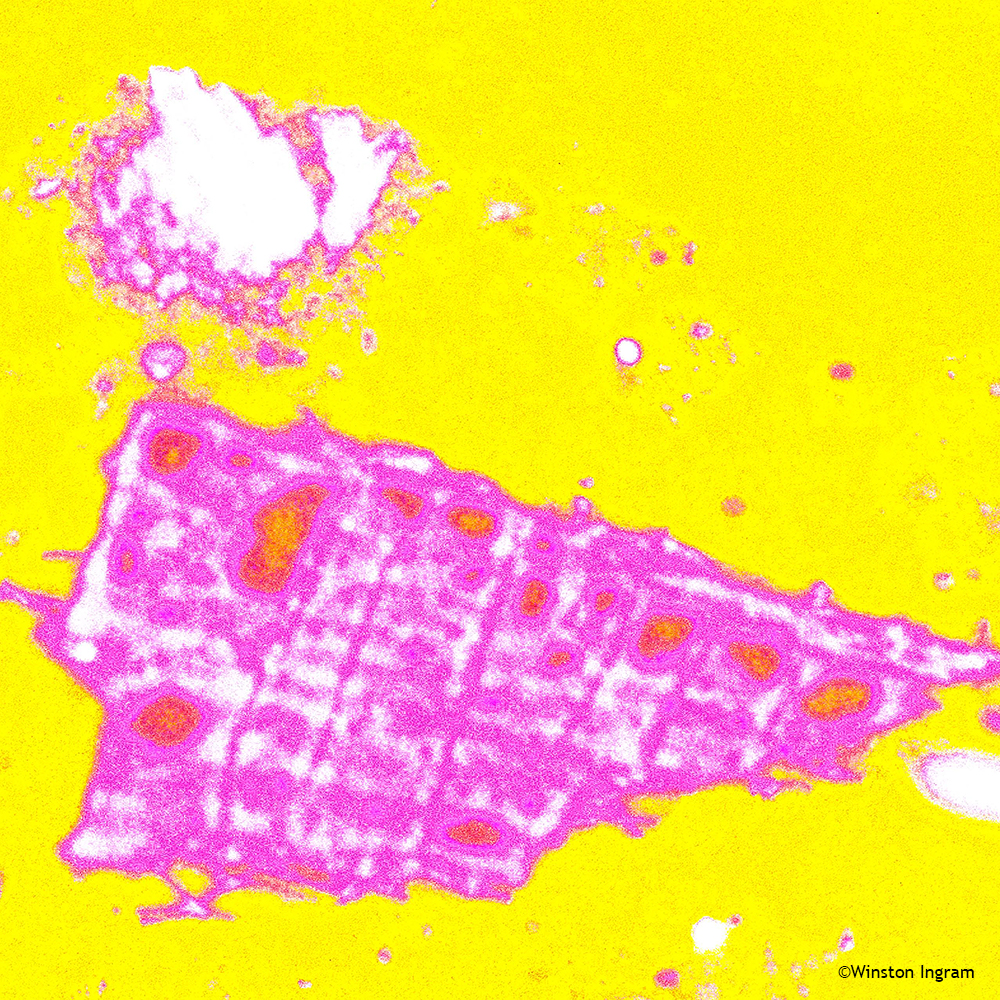 Spices | Microbus Microscope Educational Website