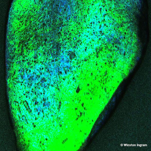 Seashells | Microbus Microscope Educational Website