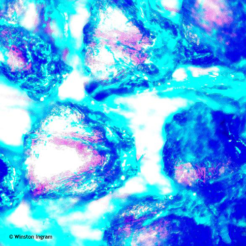 Dried Flowers | Microbus Microscope Educational Website