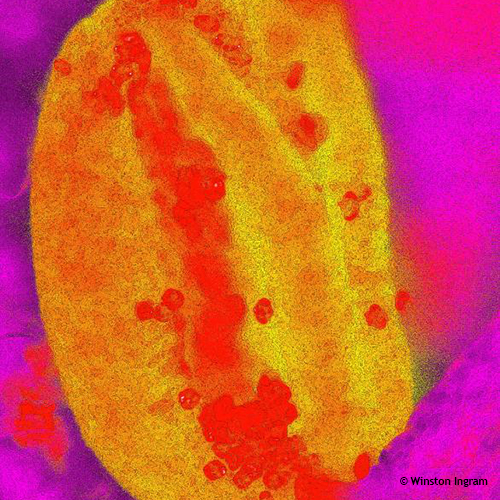 Dried Flowers | Microbus Microscope Educational Website