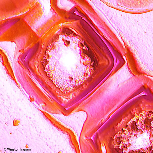 Mobile Phone | Microbus Microscope Educational Website