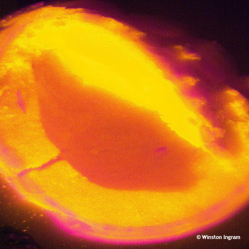 Sweets | Microbus Microscope Educational Website