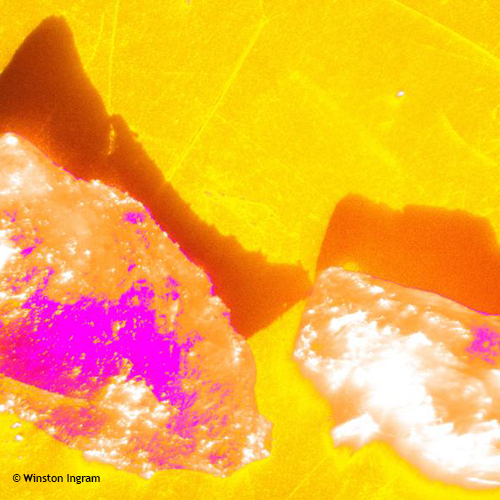 Sweets | Microbus Microscope Educational Website