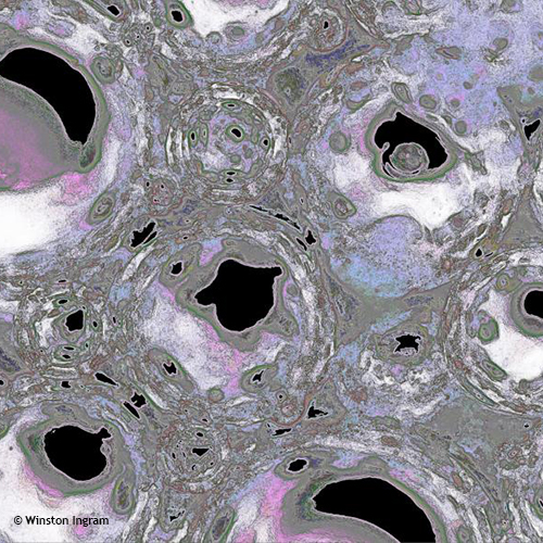 Soap | Microbus Microscope Educational Website