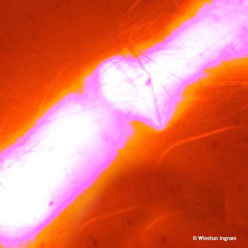 Sweets | Microbus Microscope Educational Website