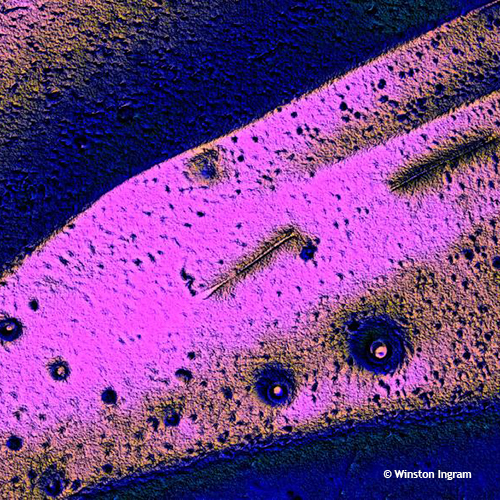 Soft Drinks | Microbus Microscope Educational Website