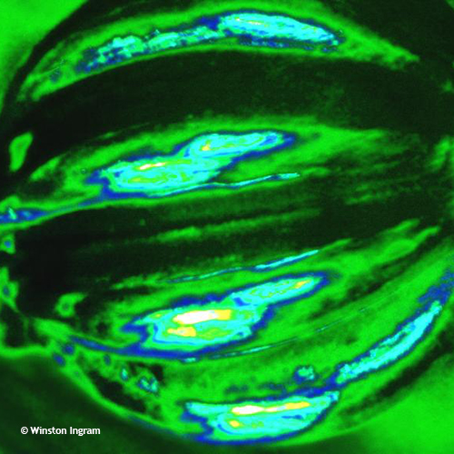 Silver Beads | Microbus Microscope Educational Website