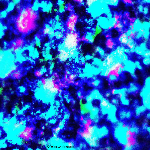 Paper & Ink | Microbus Microscope Educational Website