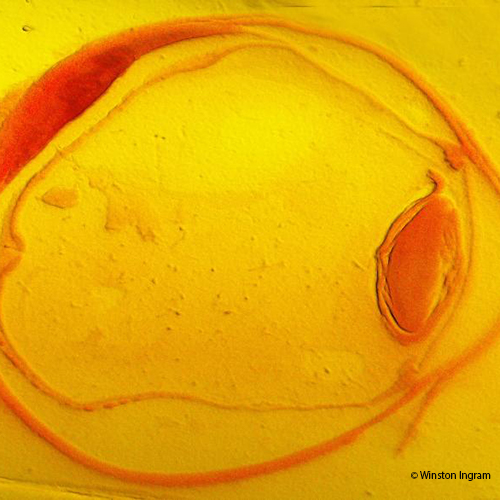 Human Eye | Microbus Microscope Educational Website