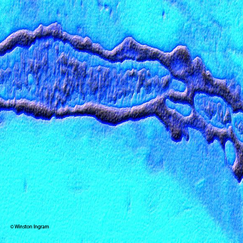 Human Eye | Microbus Microscope Educational Website