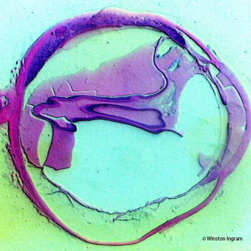 Human Eye | Microbus Microscope Educational Website