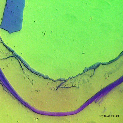 Human Eye | Microbus Microscope Educational Website