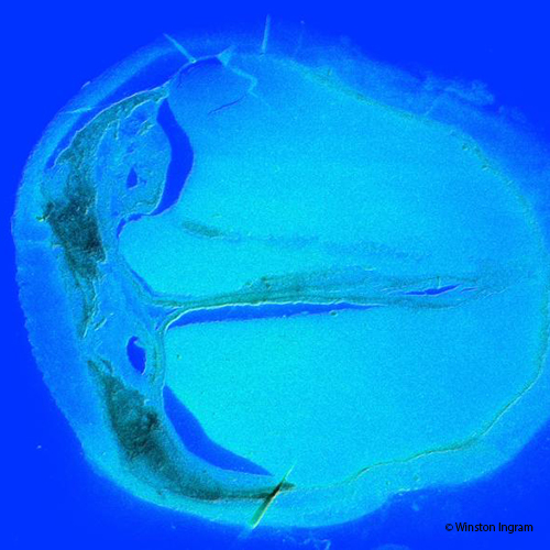 Human Eye | Microbus Microscope Educational Website