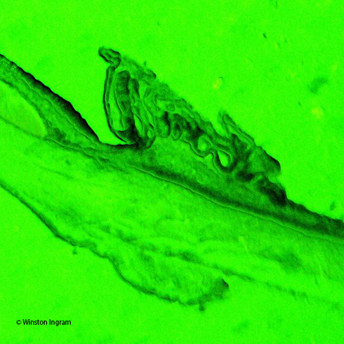 Human Eye | Microbus Microscope Educational Website