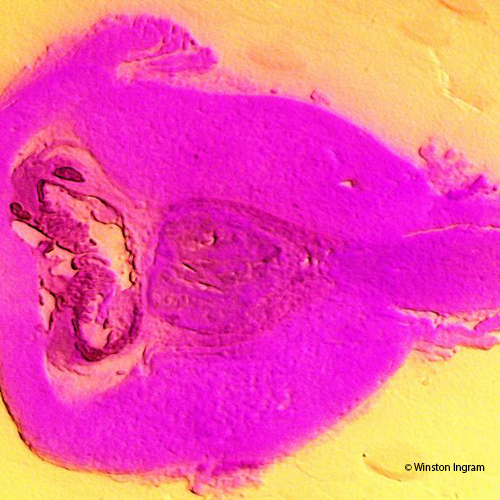 Human Eye | Microbus Microscope Educational Website