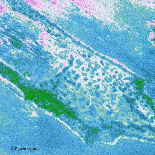 Human Teeth | Microbus Microscope Educational Website