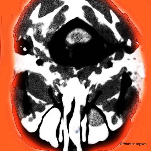 Human Brain | Microbus Microscope Educational Website