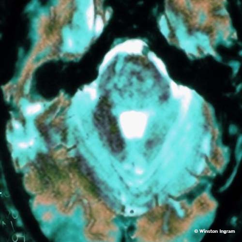 Human Brain | Microbus Microscope Educational Website