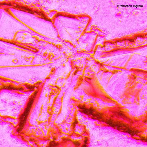 Folic Acid | Microbus Microscope Educational Website