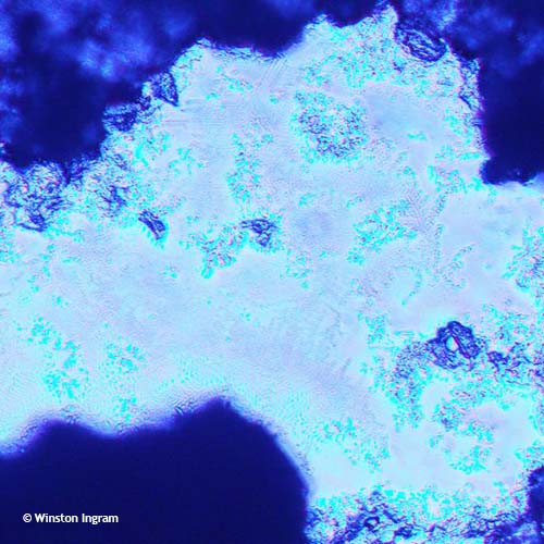 Folic Acid | Microbus Microscope Educational Website