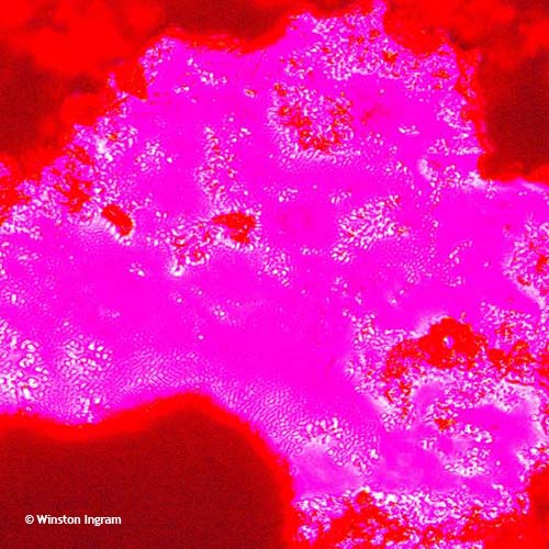 Folic Acid | Microbus Microscope Educational Website