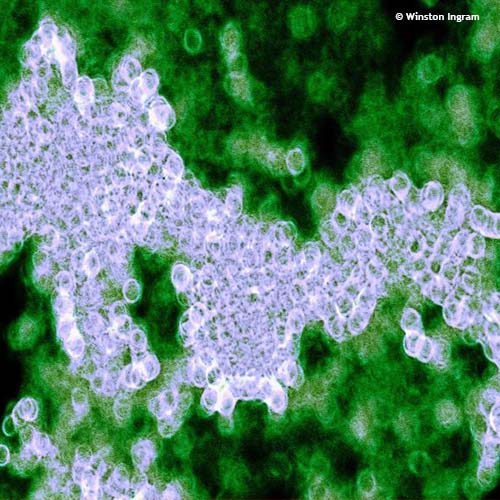 Folic Acid | Microbus Microscope Educational Website