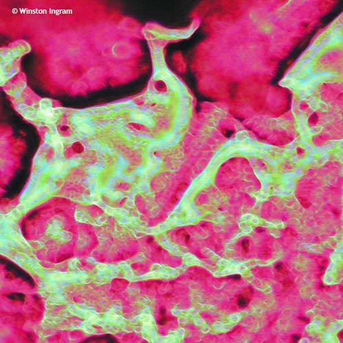 Folic Acid | Microbus Microscope Educational Website