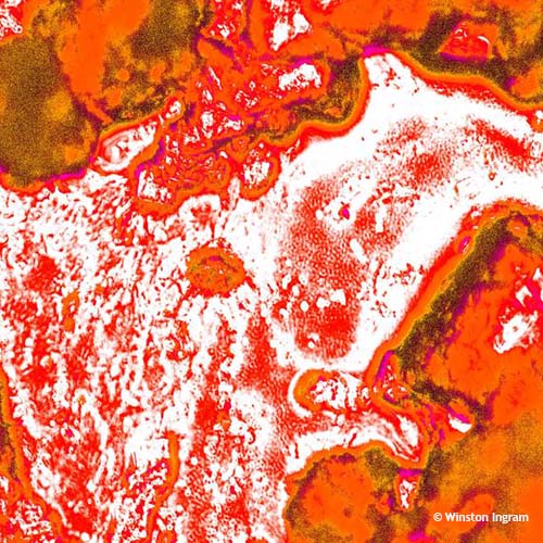 Folic Acid | Microbus Microscope Educational Website