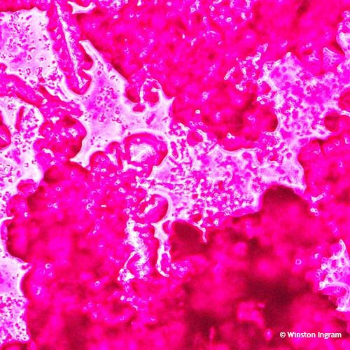 Folic Acid | Microbus Microscope Educational Website