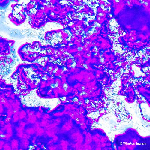 Folic Acid | Microbus Microscope Educational Website