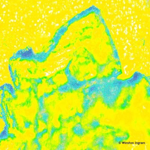Folic Acid | Microbus Microscope Educational Website