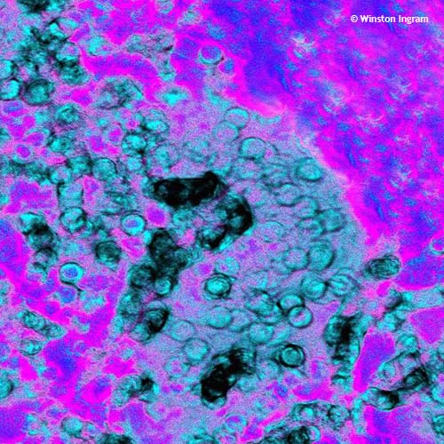 Folic Acid | Microbus Microscope Educational Website