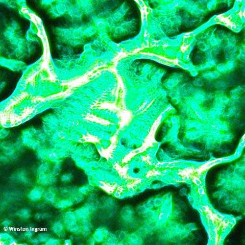 Folic Acid | Microbus Microscope Educational Website