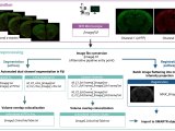 1 Imaging Segmentation And Preprocessing Smarttr