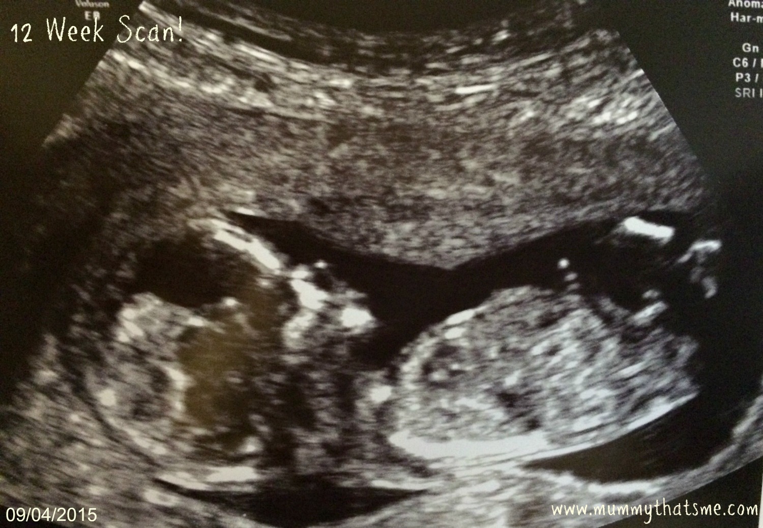 Our Little Secret! - Mum, Thats Me