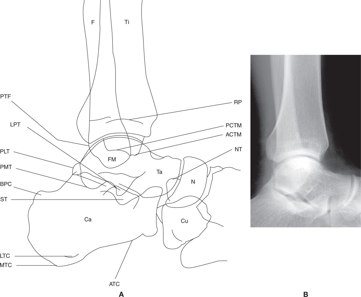 4: Positioning Techniques and Terminology | Musculoskeletal Key
