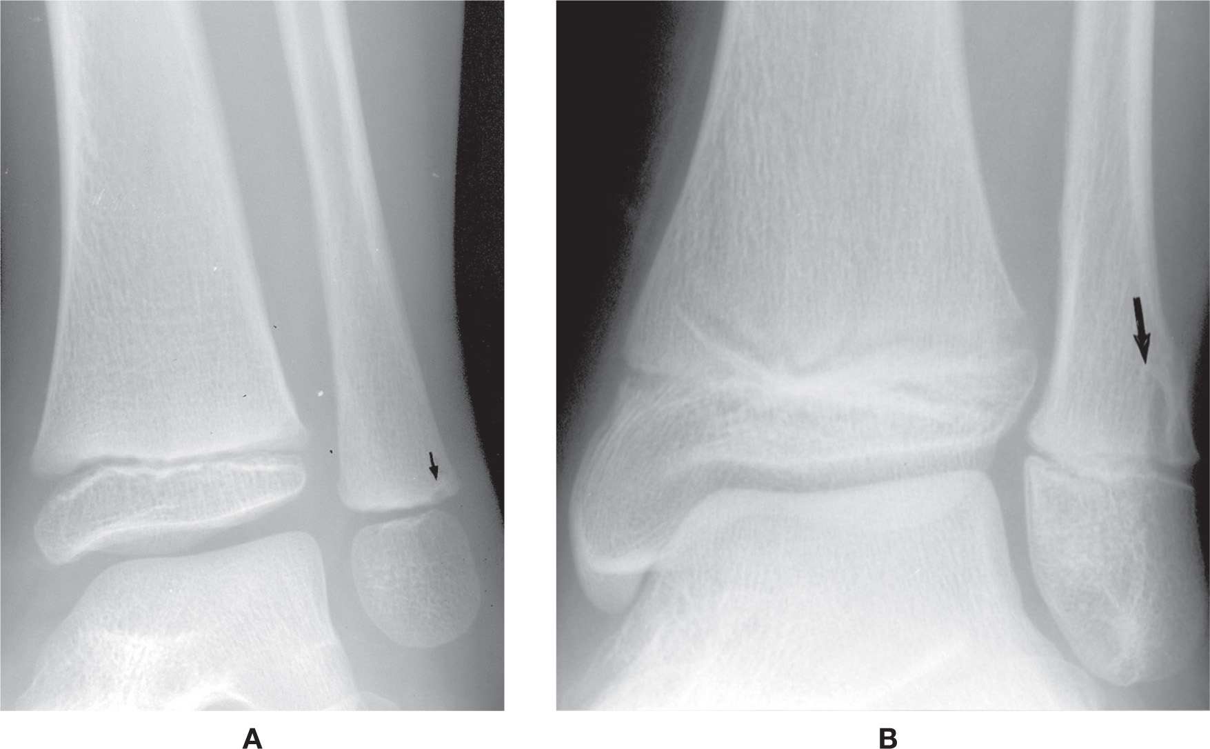 8: Developmental Variants | Musculoskeletal Key