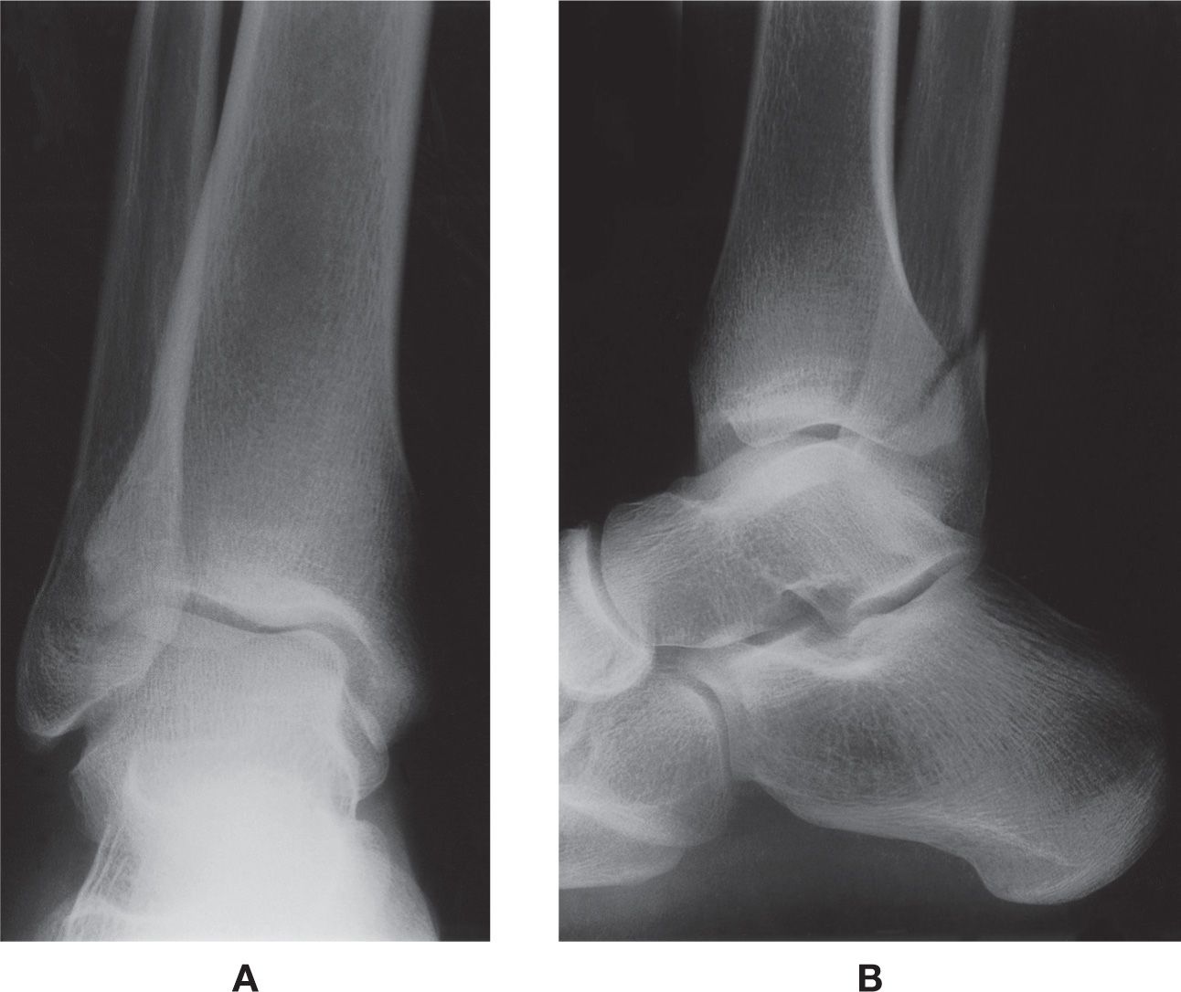 9: Principles of Radiographic Interpretation | Musculoskeletal Key