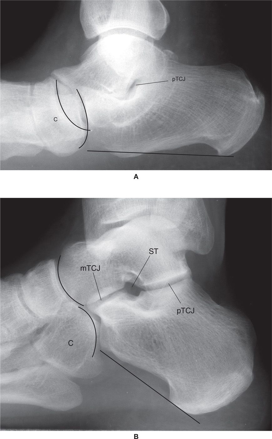 11: Systematic Evaluation of Bone and Joint Abnormalities ...