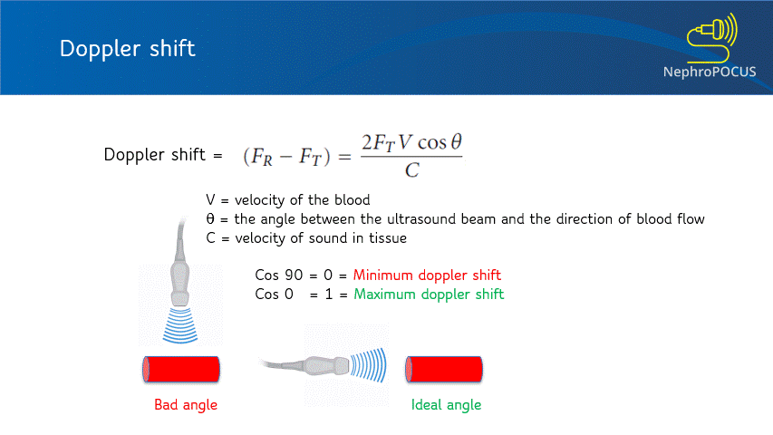 Basics of Doppler Ultrasound – NephroPOCUS