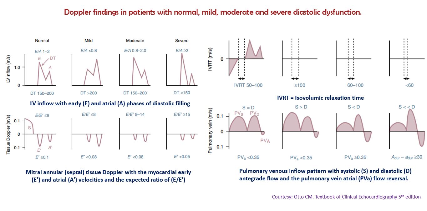 Infographics – NephroPOCUS