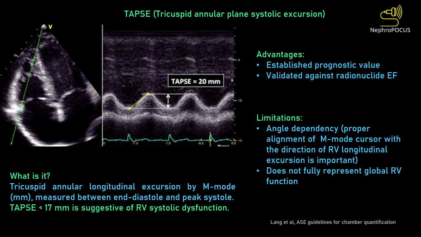 Infographics – NephroPOCUS