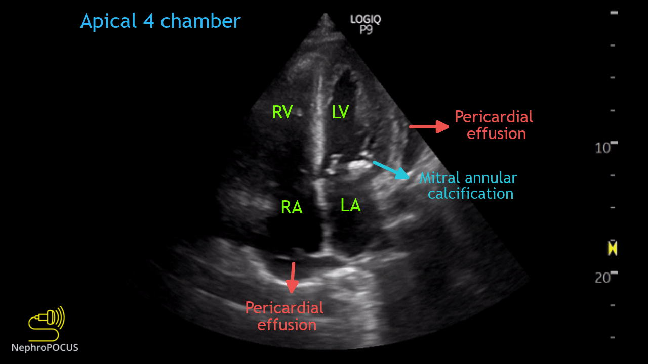 Figure-3-labeled – NephroPOCUS