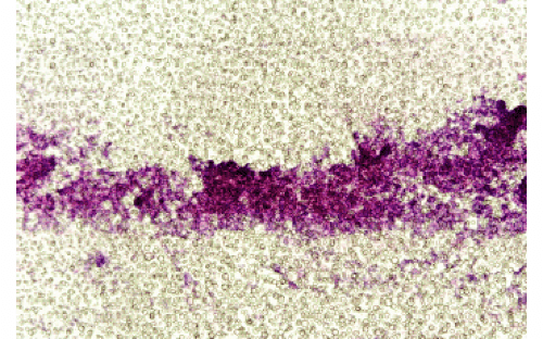 Smear Technique | Neupsy Key